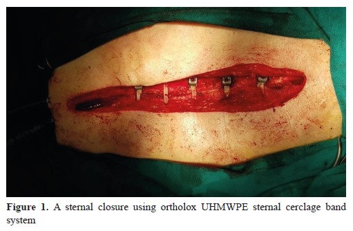 Comparison of the short and medium term efficacy of ortholox UHMWPE ...